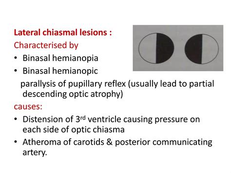 Visual Pathway And Its Lesions Pptx