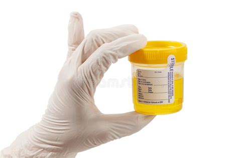Urine Sample With Glove Stock Image Image Of Antibody 31397163