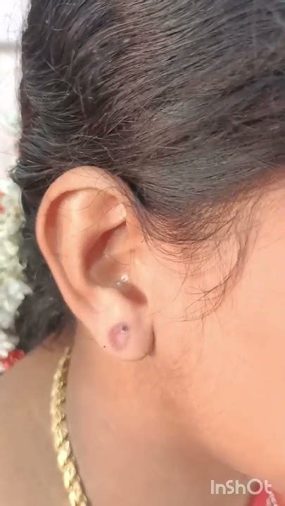 Ear Loping 15 Days After Ear Piercing Youtube