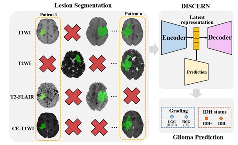 Github Xinzhen Labglioma Prediction On Missing Mri Sequences
