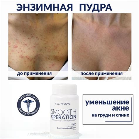 Энзимная пудра пилинг для умывания лица и тела купить на OZON по низкой ...