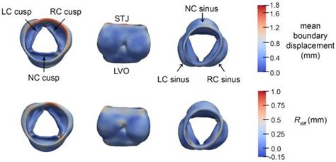 Segmentation Of The Aortic Valve Apparatus In 3d Echocardiographic Images Deformable Modeling