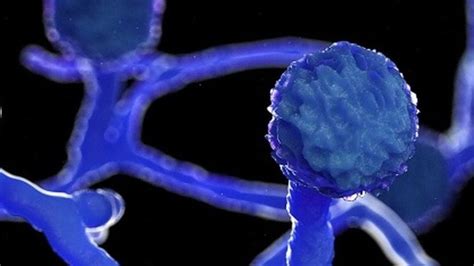 The Rise Of Invasive Fungal Infections Explained Samwaad India