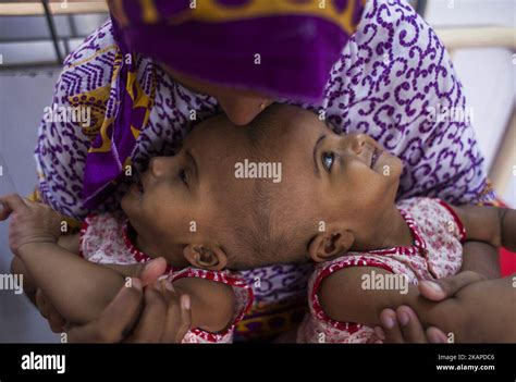 Taslima Khatun Plays With Her Twin Daughter Rabeya And Rokeya 1 Year At A Hospital In Dhaka