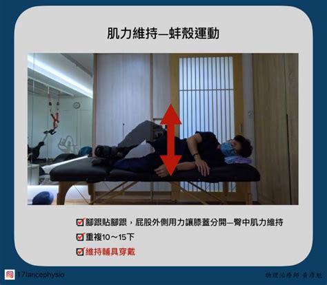 不只運動！阿基里斯腱斷裂與「這些」因素都有關 如何治療、復健？ 健康醫療網