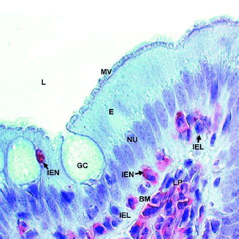 Light Microscopy Of The Intestinal Wall In Atlantic Salmon Salmo