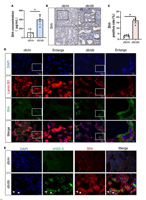 Figure 1 From Senescent Renal Tubular Epithelial Cells Activate