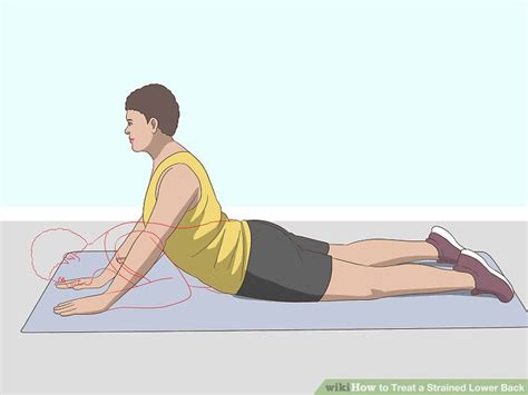 3 Easy Ways To Treat A Strained Lower Back Wikihow