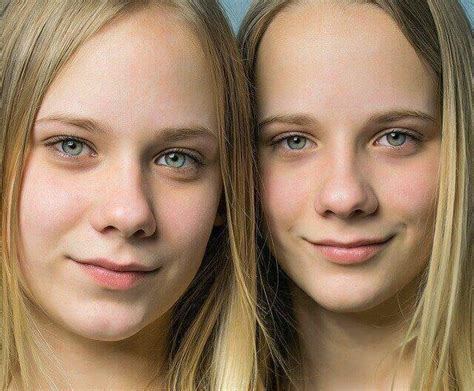 4 Difference Between Monozygotic And Dizygotic Twins 2025