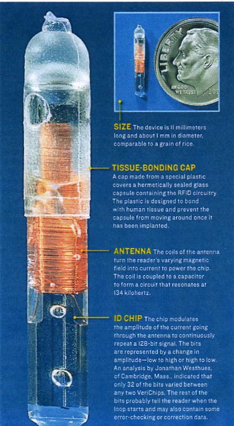 Microchip Humans Rfid