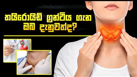 තයිරොයිඩ් ග්‍රන්ථිය ගැන ඔබ දැනුවත්ද Youtube