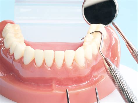 How Much Do Dentures Cost In Alberta Olds Denture And Implant Centre