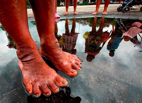 En Chocó Murieron Ocho Niños Indígenas Por La Falta De Agua Potable