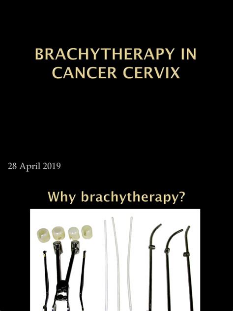 Brachytherapy In Cancer Cervix Medical Specialties Clinical Medicine