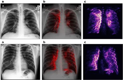 Figure 4 From Explaining Deep Neural Networks In A Medical Imaging