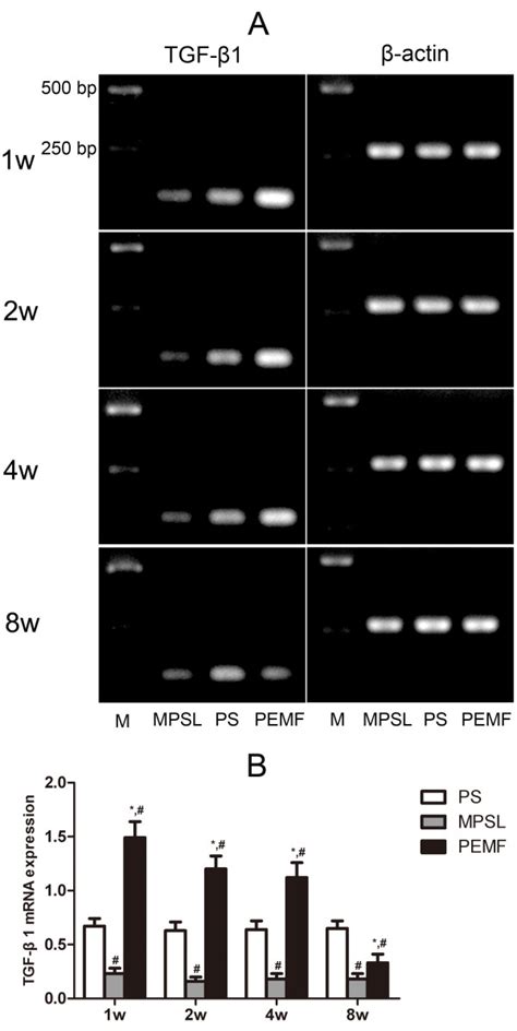 Mrna Expression Of Tgf β1 In Proximal Femur A Mrna Expression Levels