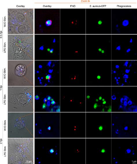 Intracellular Location Of S Aureus−fnd Conjugates Inside Macrophages