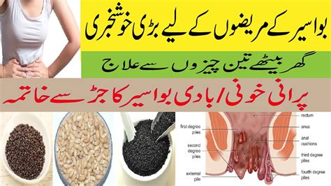 Bawaseer Ilaj Bawaseer Ko Khatam Krny Ka Triqa Bawaseer Ka Desi Ilaj