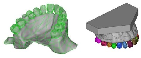 Scan Of The Maxillary Dentition Download Scientific Diagram