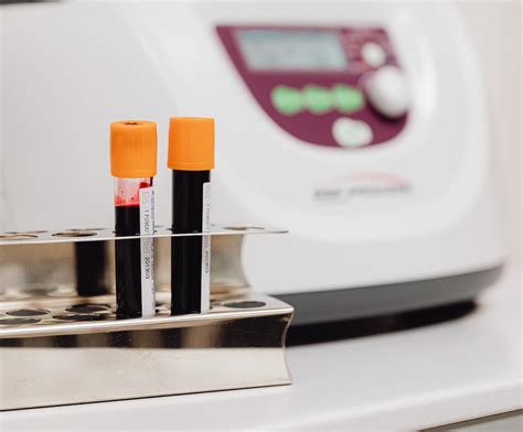 Arteriosklerose Symptome And Ursachen Die Blutwerte App