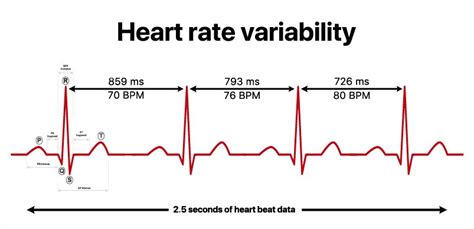 The Gold Standard Of Data Tracking For Health Longevity And Wellness Heart Rate Variability