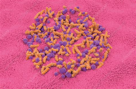 Fungal Skin Infection Illustration Stock Image F Science Photo Library