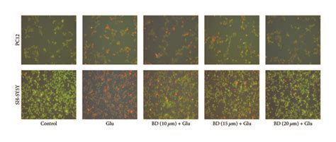 Cell Morphology Of Pc12 And Sh Sy5y Cells Stained With Acridine Orange