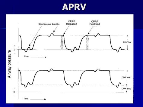 Ppt Airway Pressure Release Ventilation Aprv Powerpoint Presentation Id3948571
