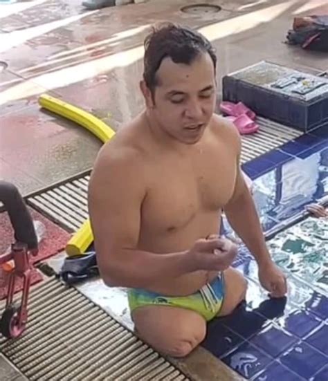 Dak Amputee Video 26
