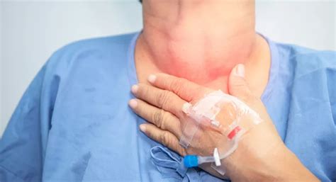 Tratamiento del cáncer de tiroides y seguimiento del paciente