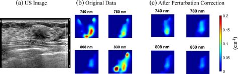 Reducing Image Artifact In Diffuse Optical Tomography By Iterative