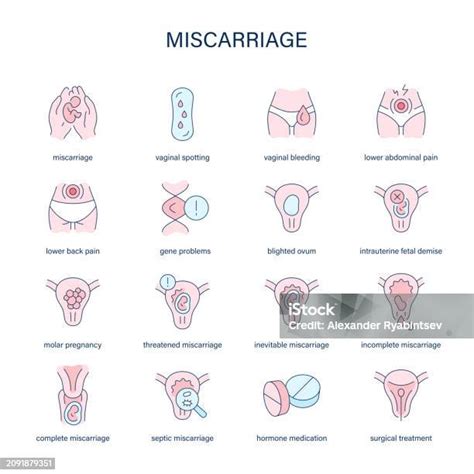 Ilustración De Síntomas De Aborto Espontáneo Iconos Vectoriales De