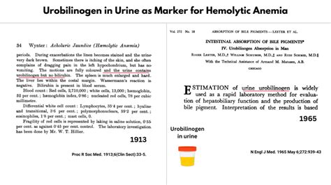 Urobilinogen In Hemolytic Anemia • The Blood Project