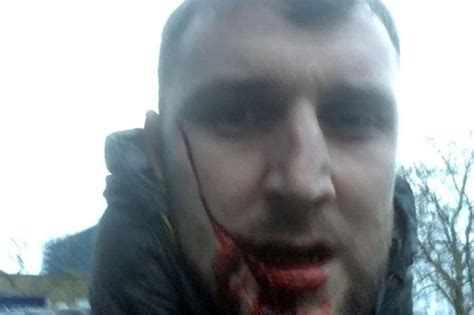 Participó De Una Batalla De Ultras En Inglaterra Y Terminó Con Una