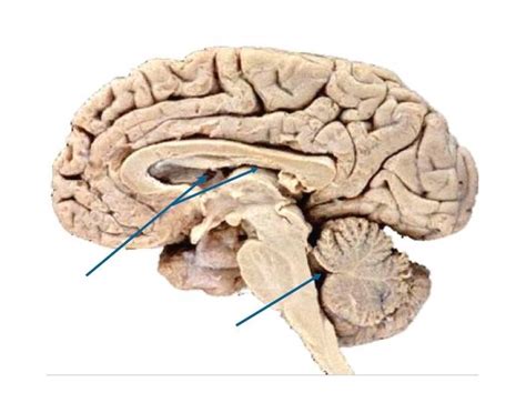 Structures Related To Csf Part 1 Quiz