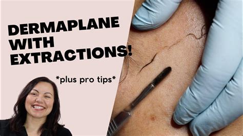 Must Watch Dermaplane With Pro Tips Youtube