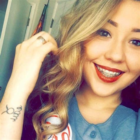 Ruby Red Lips And Braces Scrolller