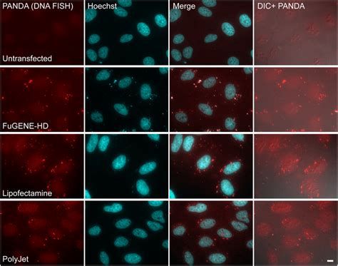 The Cytoplasmic Puncta Forming After Transient Transfection Are