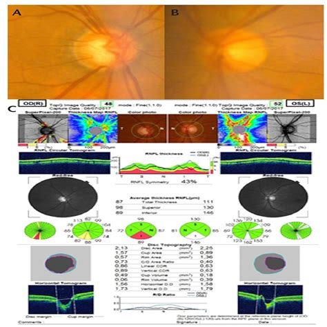 The Asia Pacific Journal Of Ophthalmology