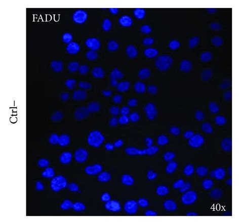 Immunofluorescence Staining Of Eef1α In Three Hpv Cell Lines With