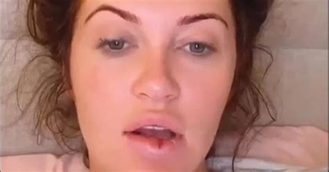 Charlotte Dawson In Agony And Cant Move Leg After Scooter Accident