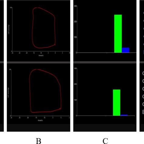 Using A Commercially Available Software Analyzing Lv Myocardial Work Download Scientific