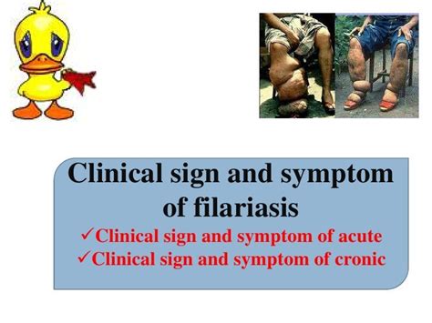 Presentation Filariasis