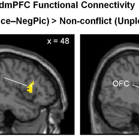 Brain Regions Showing Stronger Functional Connectivity With The Dmpfc Download Scientific