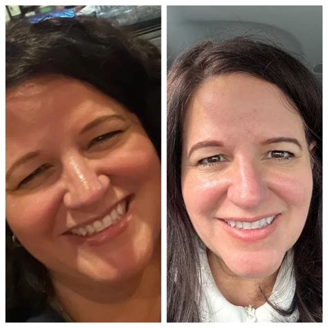 Ozempic Weight Loss Reviews What People Are Saying
