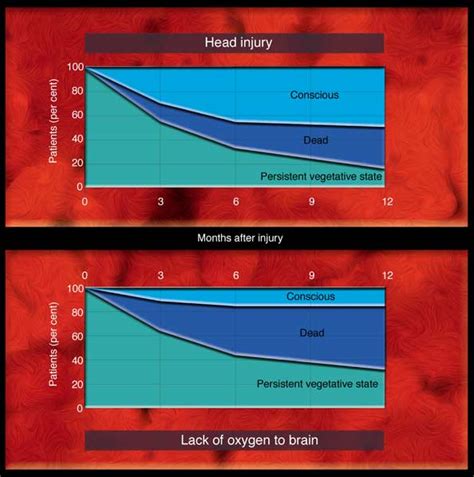 Vegetative State Wikiwand Articles