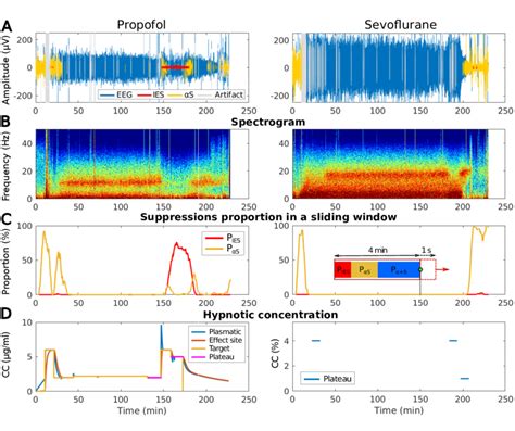 Difference Of EEG Waveform Spectrogram Suppressions Proportion And