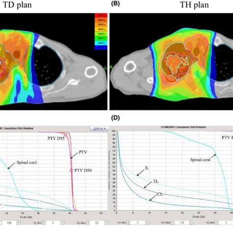 The Isodose Curve Distributions Of The Paired Plan For Patient No 3 Download Scientific