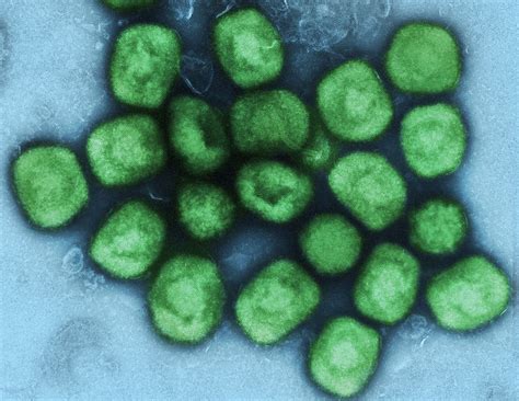 Mpox on the Rise What Really Helps Deutsche Stiftung Weltbevölkerung