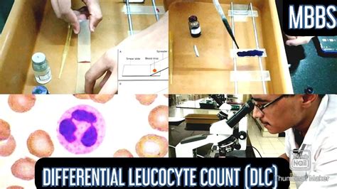 Test For Differential Leukocyte Count At Dominic Chumleigh Blog
